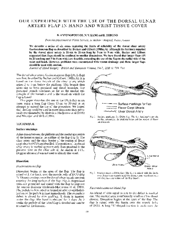 (PDF) Our Experience with the Use of the Dorsal Ulnar Artery Flap in ...