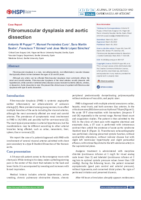 (PDF) Fibromuscular dysplasia and aortic dissection