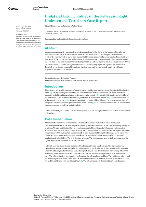 (PDF) Unilateral Ectopic Kidney in the Pelvis and Right Undescended ...
