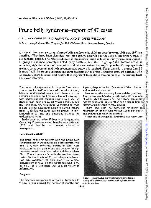 (PDF) Prune belly syndrome--report of 47 cases