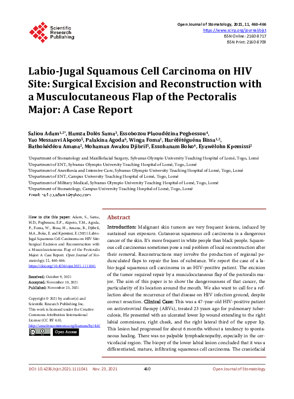 (PDF) Labio-Jugal Squamous Cell Carcinoma on HIV Site: Surgical ...