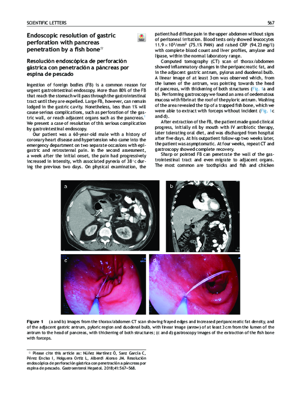(PDF) Endoscopic resolution of gastric perforation with pancreas ...