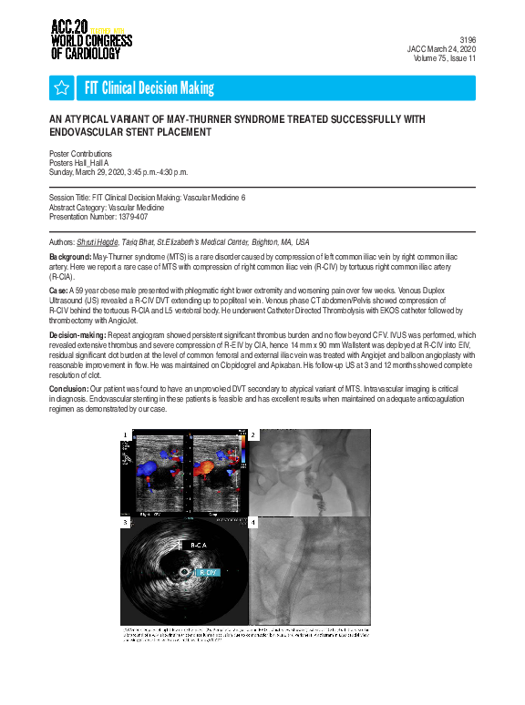 (PDF) An Atypical Variant of May-Thurner Syndrome Treated Successfully ...