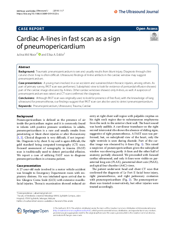 (PDF) Cardiac A-lines in fast scan as a sign of pneumopericardium