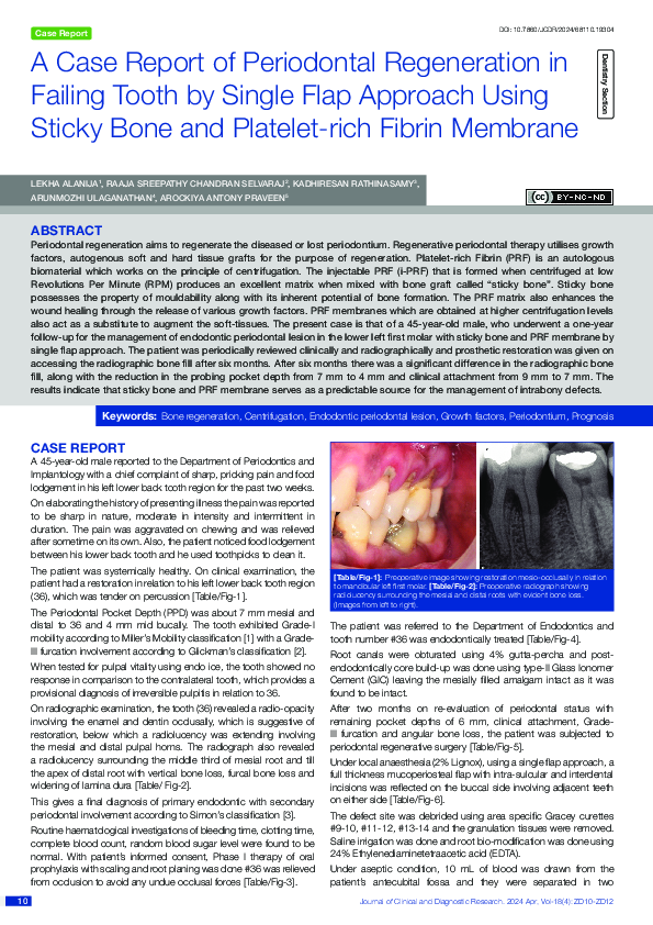 (PDF) A Case Report of Periodontal Regeneration in Failing Tooth by ...