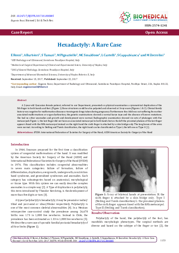 (PDF) Hexadactyly, A Rare Case