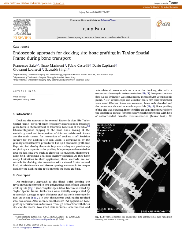 (PDF) Endoscopic approach for docking site bone grafting in Taylor ...