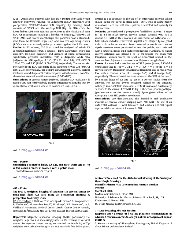(PDF) The first T2-weighted imaging of stage IB1–IIB cervical cancer by ...