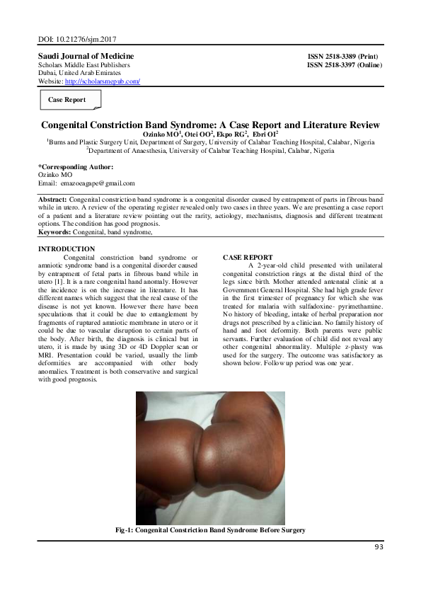 (PDF) Congenital Constriction Band Syndrome : A Case Report and ...