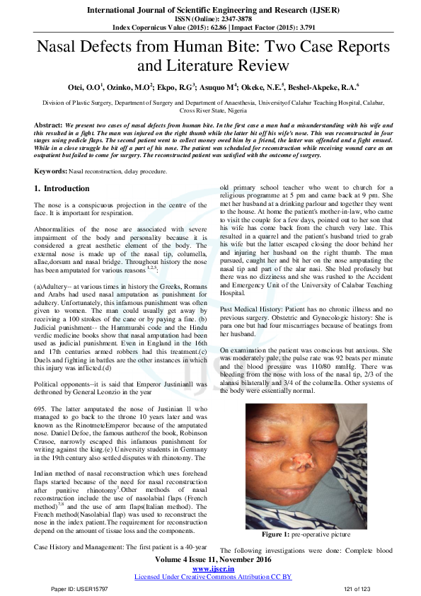 (PDF) Nasal Defects from Human Bite: Two Case Reports and Literature Review