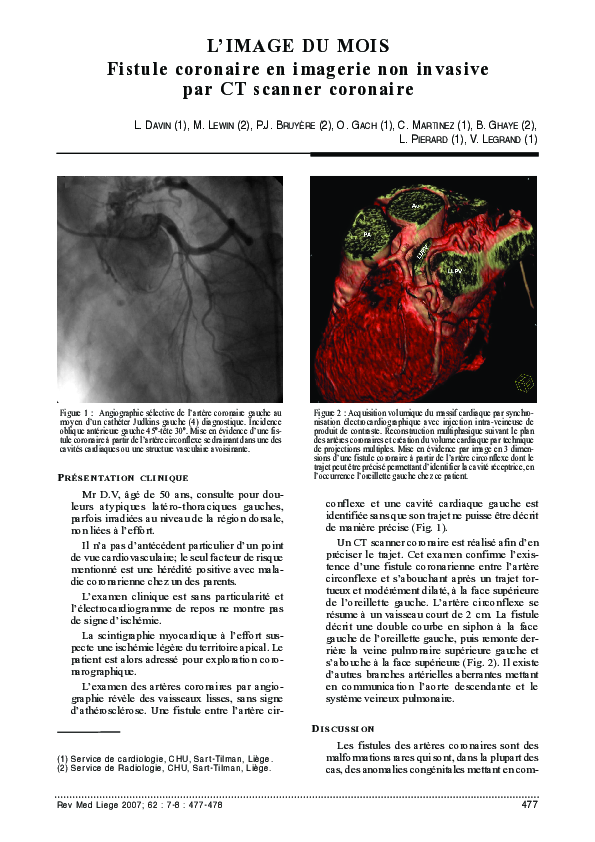 (PDF) L'image du mois. Fistule coronaire en imagerie non invasive par ...