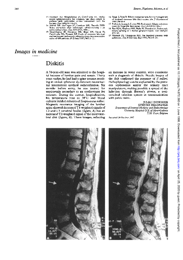 (PDF) Images in medicine. Diskitis | Etienne Delgrange - Academia.edu