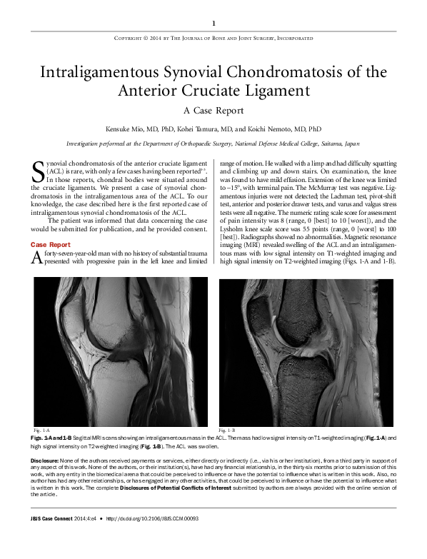 (PDF) Intraligamentous synovial chondromatosis of the anterior cruciate ...