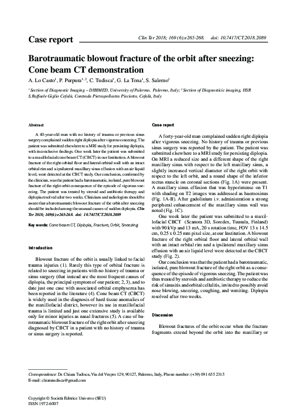 (PDF) Barotraumatic blowout fracture of the orbit after sneezing: Cone ...