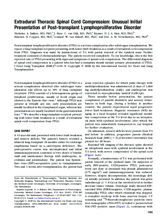 (PDF) Extradural Thoracic Spinal Cord Compression: Unusual Initial ...