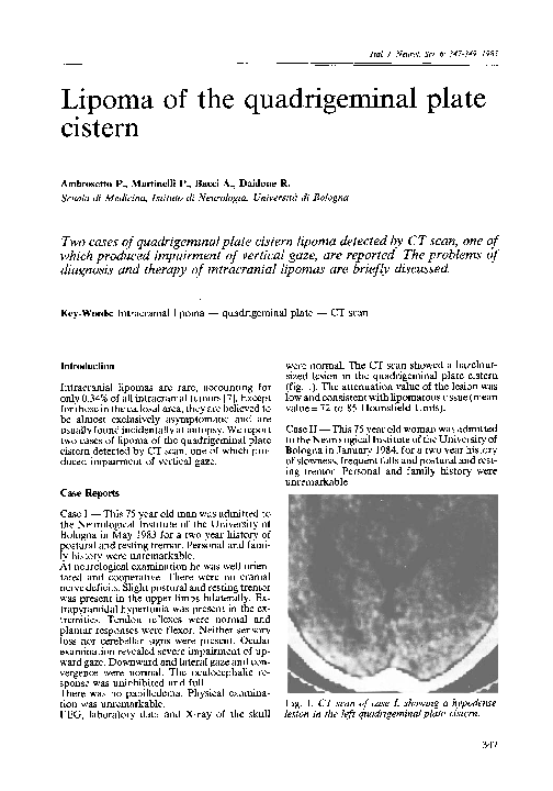 (PDF) Lipoma of the quadrigeminal plate cistern | Asif Rahman ...