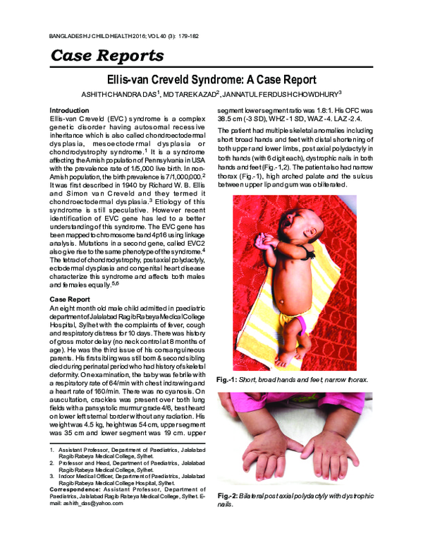 (PDF) Ellis-van Creveld Syndrome: A Case Report