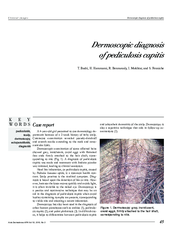 (PDF) Dermoscopic diagnosis of pediculosis capitis