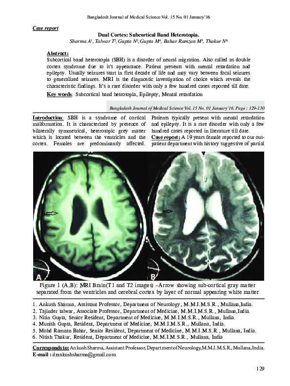 (PDF) Dual Cortex: Subcortical Band Heterotopia