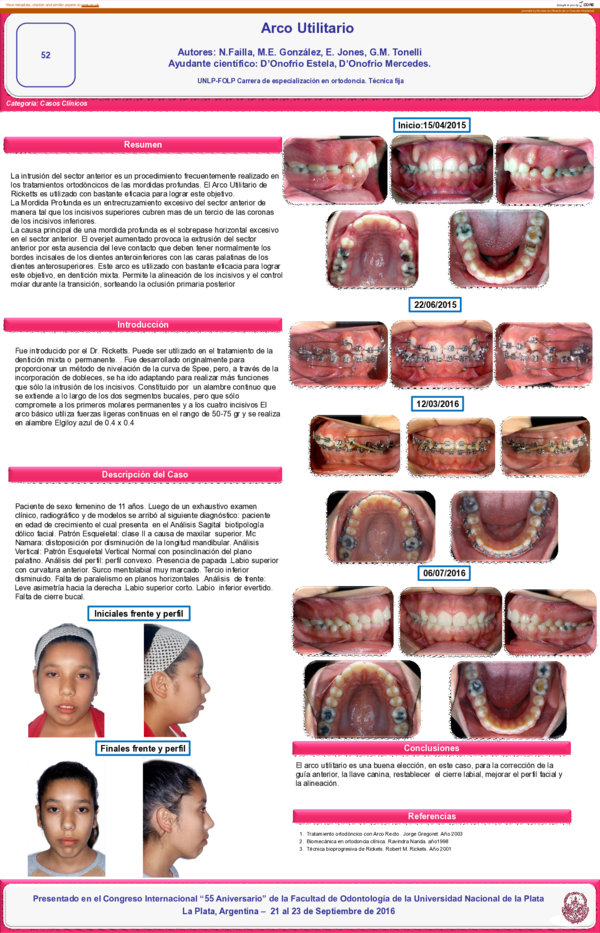 (PDF) Arco utilitario