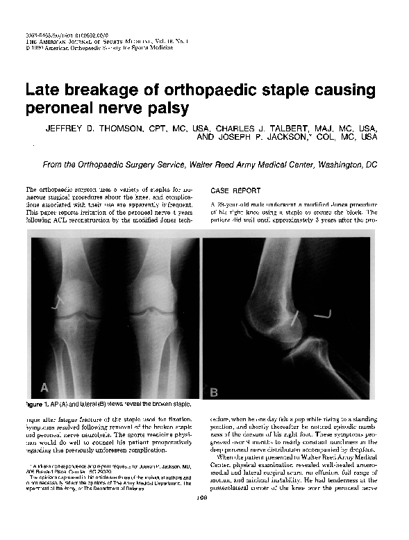 (PDF) Late breakage of orthopaedic staple causing peroneal nerve palsy