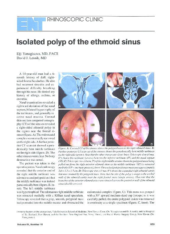 (PDF) Isolated Polyp of the Ethmoid Sinus