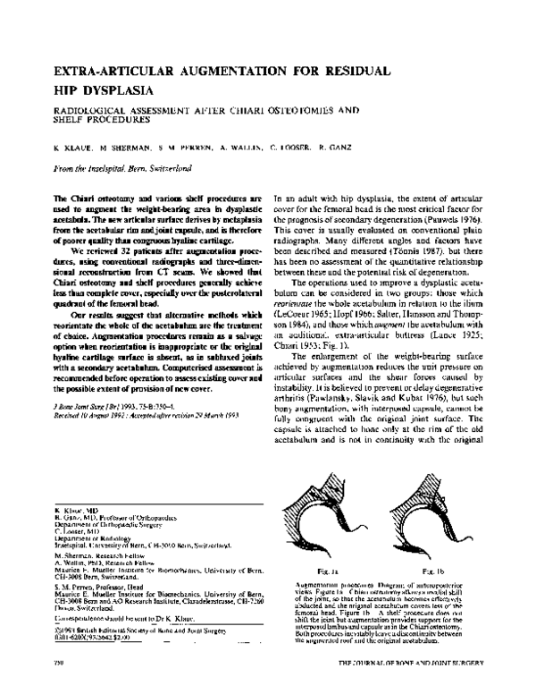 (PDF) Extra-articular augmentation for residual hip dysplasia ...