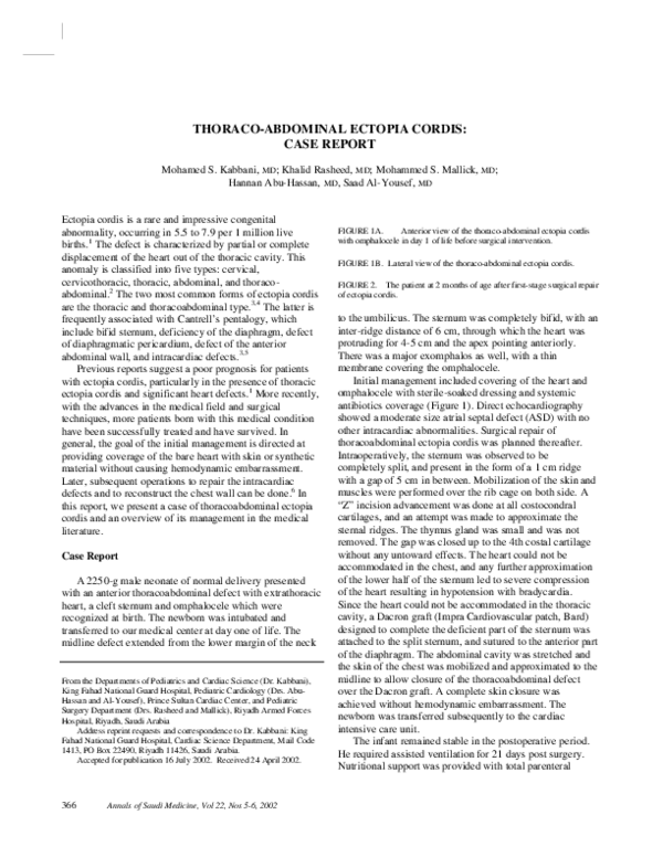 Pdf Thoracoabdominal Ectopia Cordis A Case Report Selim Kervancıoğlu