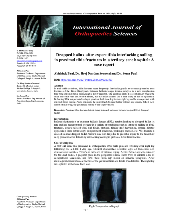 (PDF) Dropped hallux after expert tibia interlocking nailing in proximal tibia fractures in a ...