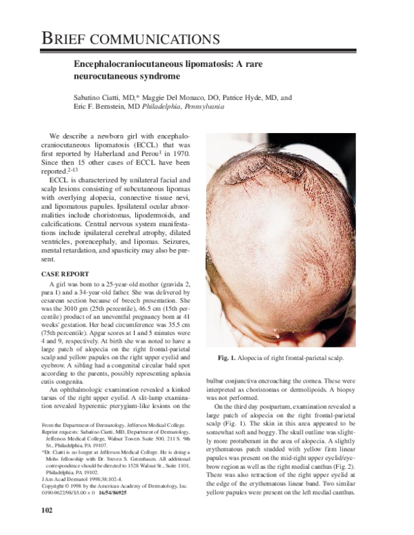 (PDF) Encephalocraniocutaneous lipomatosis: A rare neurocutaneous syndrome