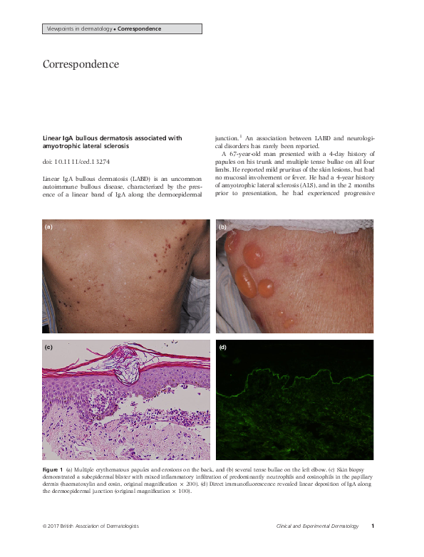 (PDF) Linear IgA Bullous Dermatosis Associated with Vancomycin