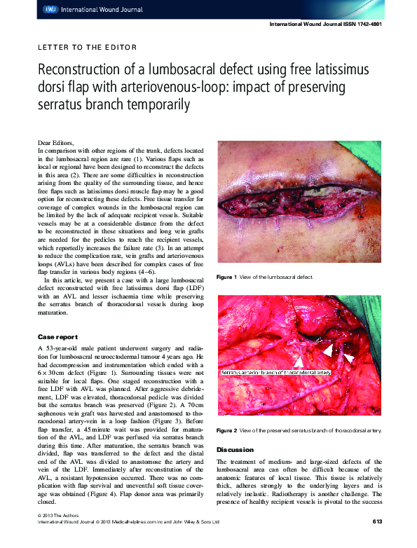 (PDF) Reconstruction of a lumbosacral defect using free latissimus ...