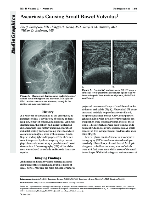 (PDF) Ascariasis Causing Small Bowel Volvulus