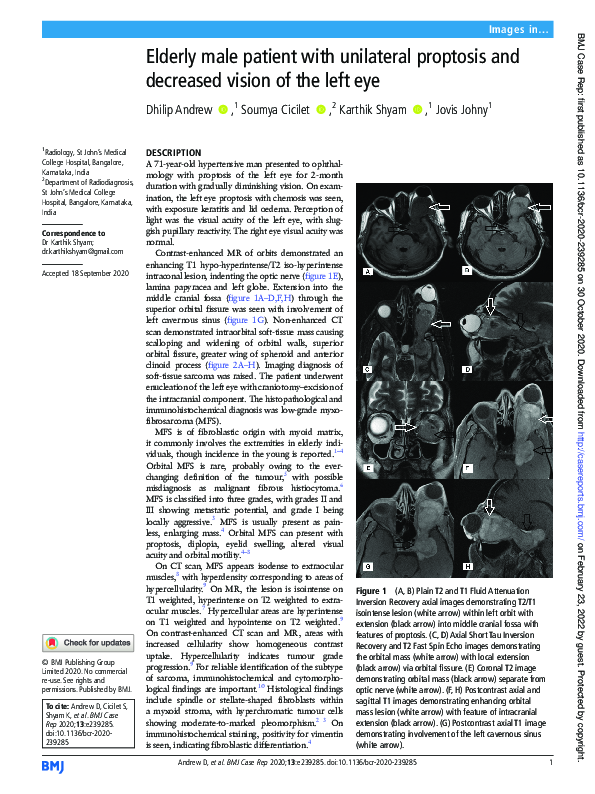 (PDF) Elderly male patient with unilateral proptosis and decreased ...