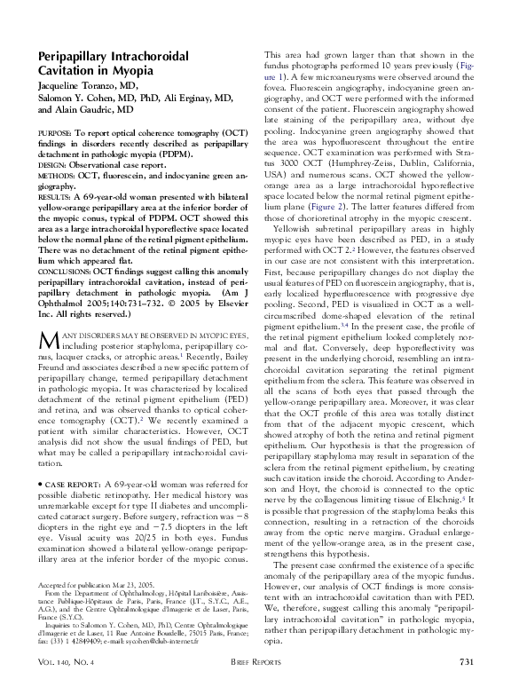 (PDF) Peripapillary Intrachoroidal Cavitation in Myopia