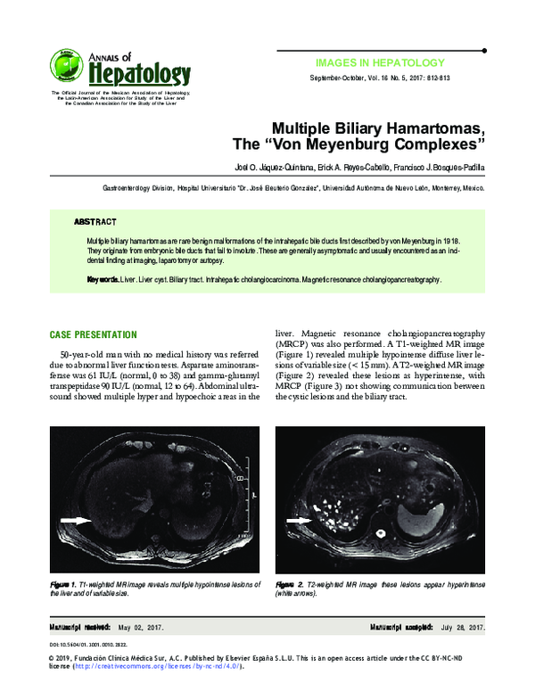 (PDF) Multiple Biliary Hamartomas (Von Meyenburg Complex): A Case ...
