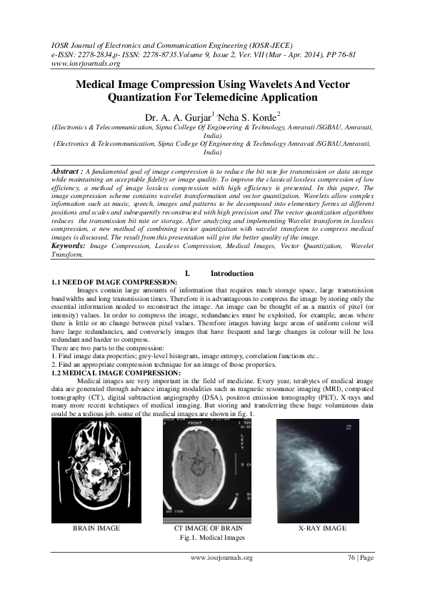 (PDF) Medical Image Compression Using Wavelets And Vector Quantization For Telemedicine Application