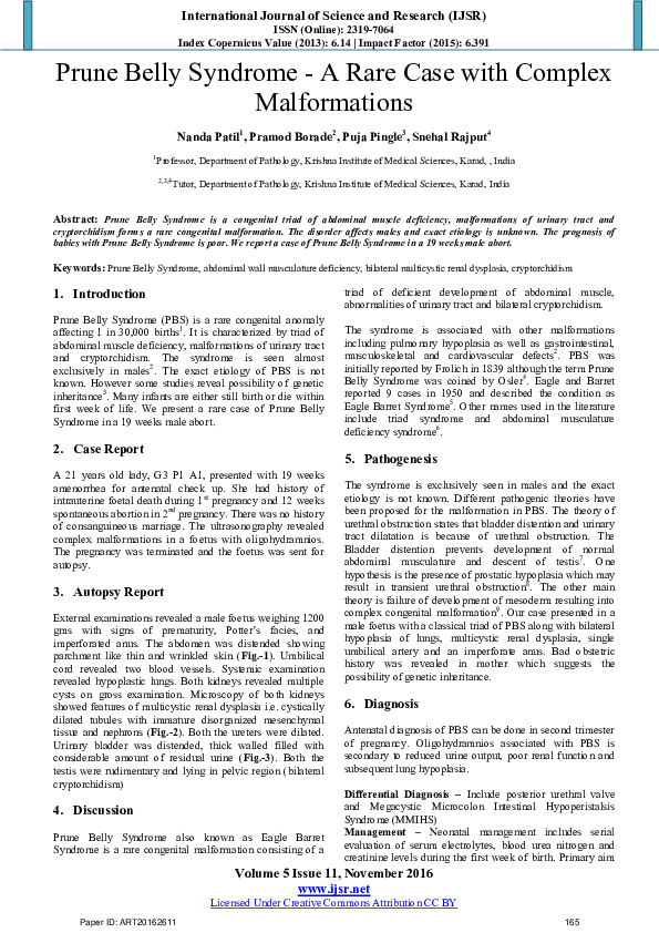 (PDF) Prune Belly Syndrome-A Rare Case with Complex Malformations