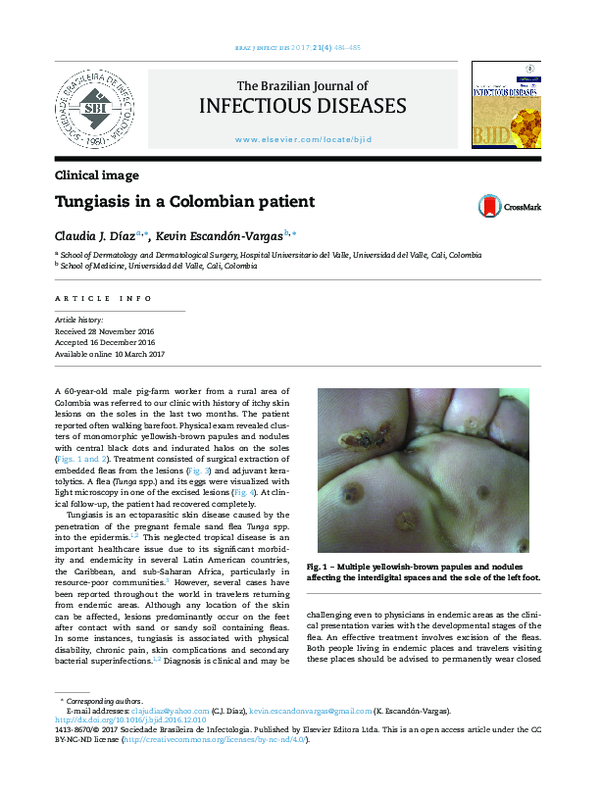 (PDF) Tungiasis in a Colombian patient