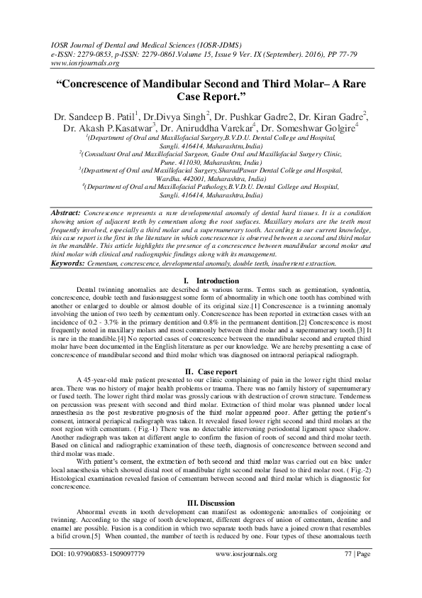 (PDF) “Concrescence of Mandibular Second and Third Molar– A Rare Case ...