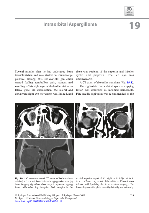 (PDF) Intraorbital Aspergilloma