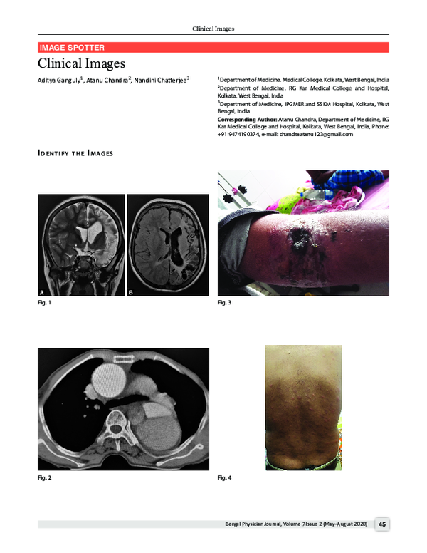 (PDF) Clinical Images