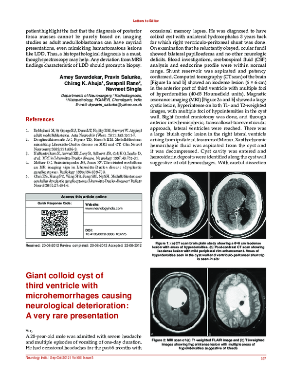 (PDF) Giant colloid cyst of third ventricle with microhemorrhages ...