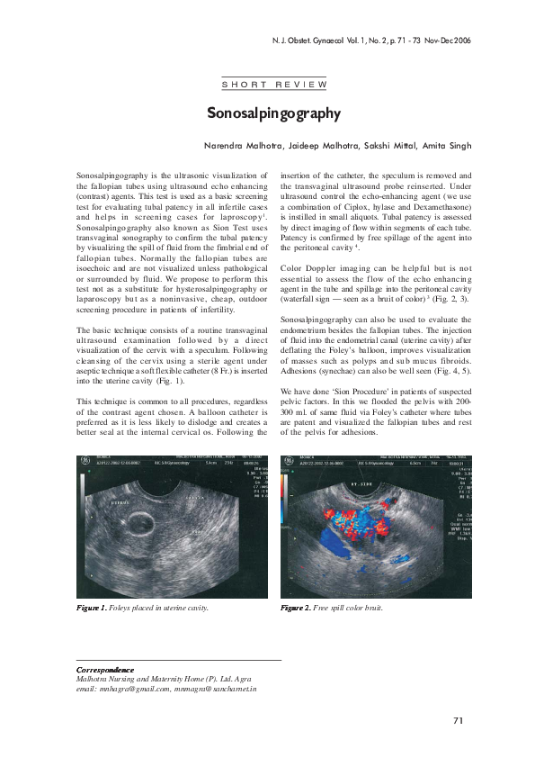 (PDF) Sonosalpingography