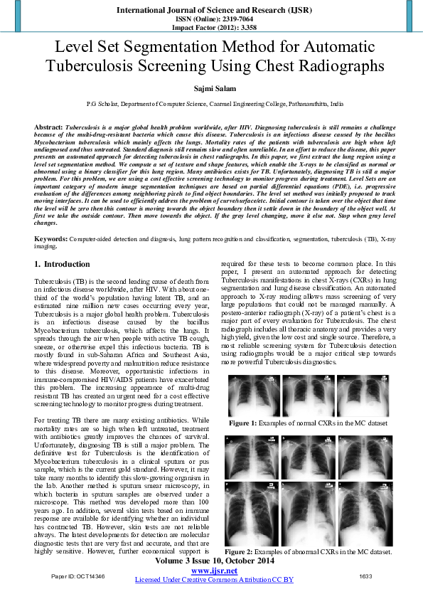 (PDF) Level Set Segmentation Method for Automatic Tuberculosis Screening Using Chest Radiographs