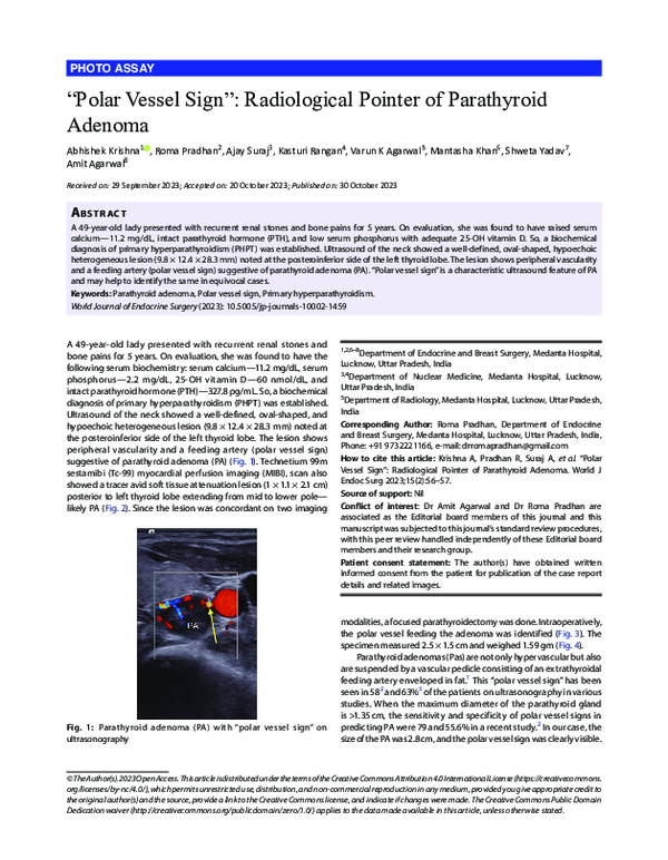 (PDF) “Polar Vessel Sign”: Radiological Pointer of Parathyroid Adenoma