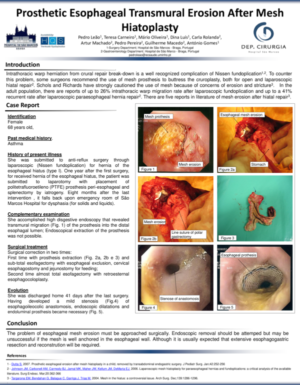 (PDF) Prosthetic Esophageal Transmural Erosion After Mesh Hiatoplasty