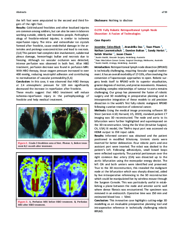 (PDF) Fully Robotic Retroperitoneal Lymph Node Dissection- A Fusion of ...