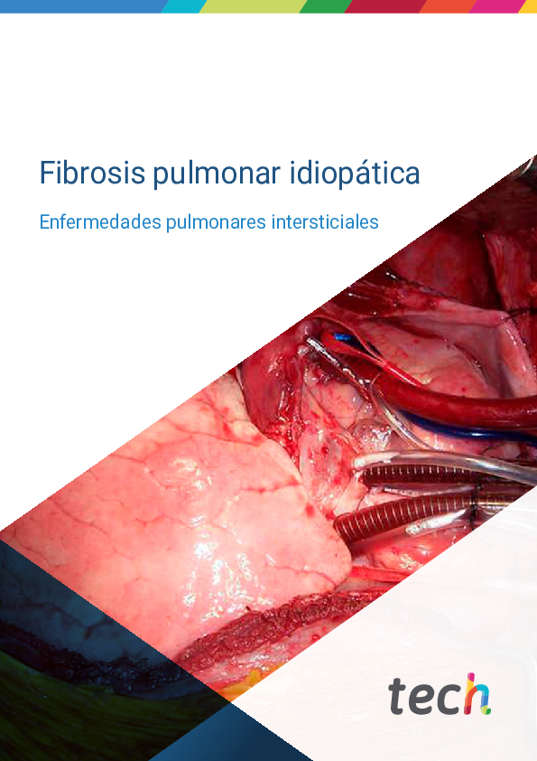 (PDF) Fibrosis pulmonar idiopática