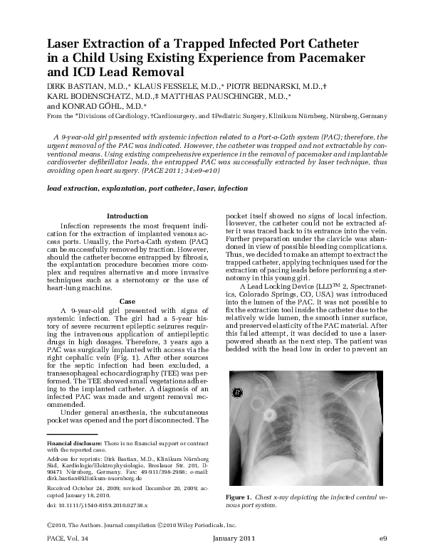 (PDF) Laser Extraction of a Trapped Infected Port Catheter in a Child ...